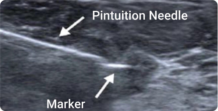 Reasons to Switch to Sirius Pintuition®