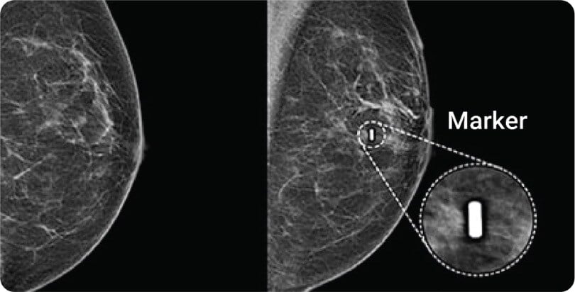 Reasons to Switch to Sirius Pintuition®